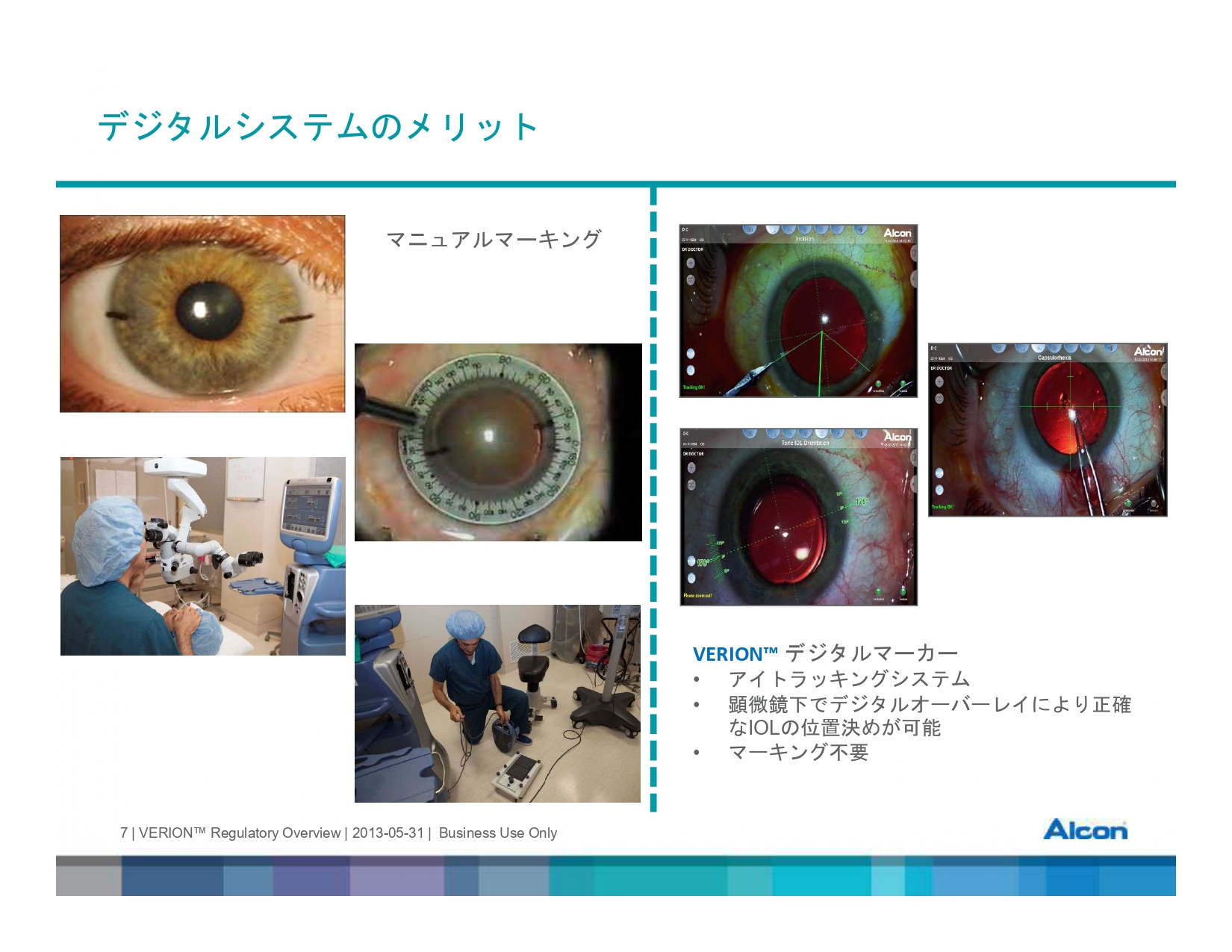 イメージガイドシステム「VERION」の導入｜世田谷あもう眼科クリニック